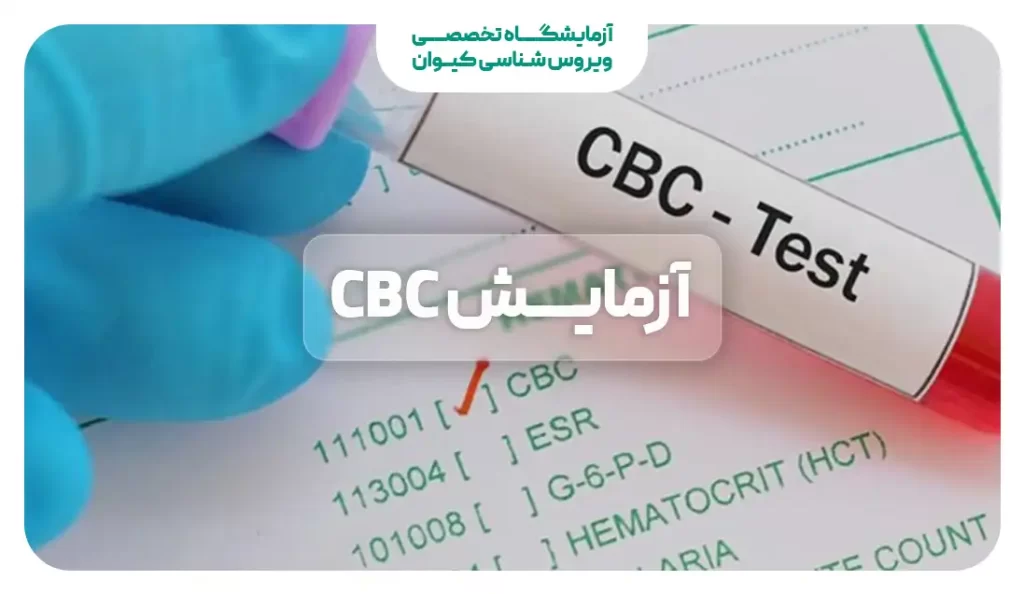 تست CBC چیست و چه اهمیتی دارد؟ | مجله سلامت کیوان