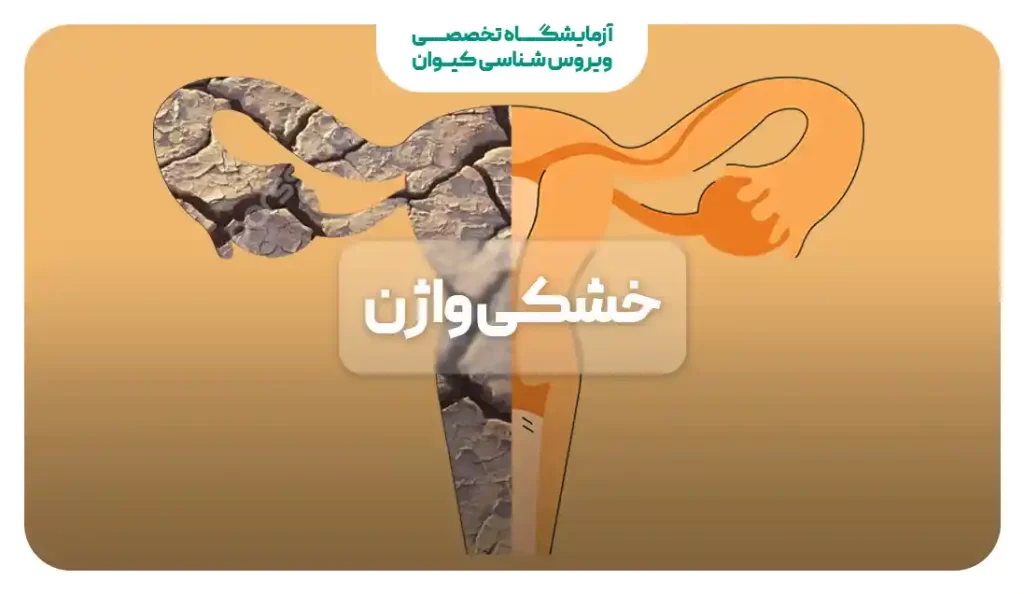خشکی واژن چیست؟ درمان خشکی واژن چگونه انجام می شود؟