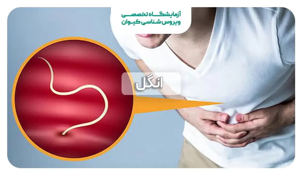 انواع انگل ها چیست؟ + روش‌ های درمان و پیشگیری